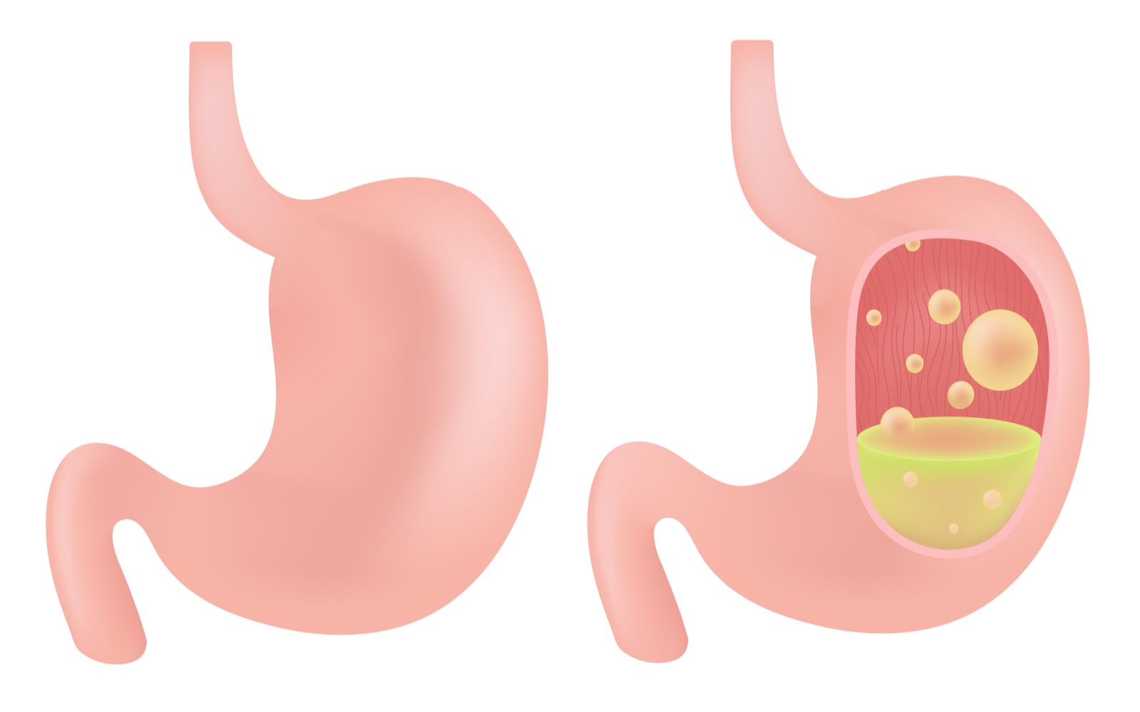 Digestive Enzymes For Bloating And Gas: Support Your Gut